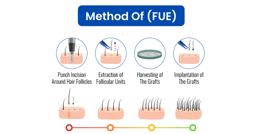The Science Behind Hair Transplants: How It Works and Why It’s Effective ? - Best Hair Help