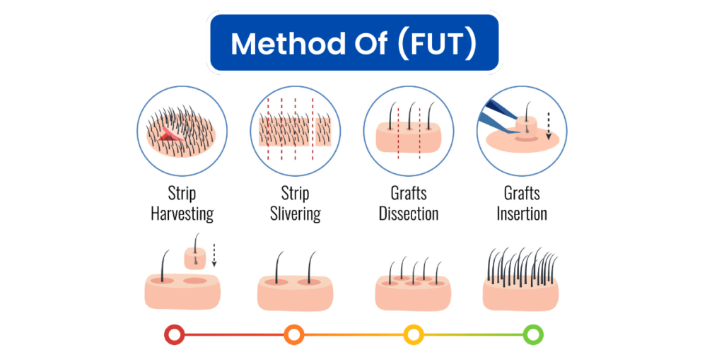 The Science Behind Hair Transplants: How It Works and Why It’s ...