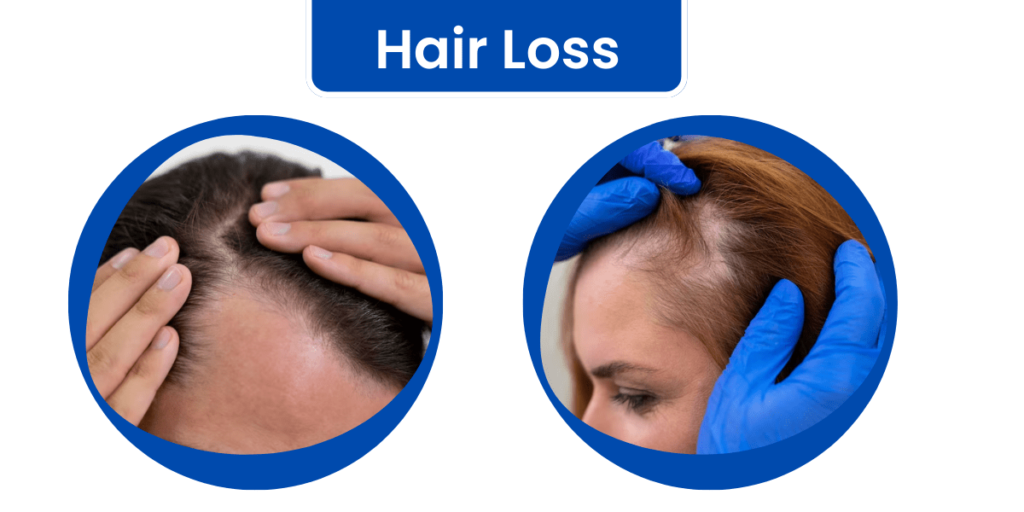 The Science Behind Hair Transplants: How It Works and Why It’s ...