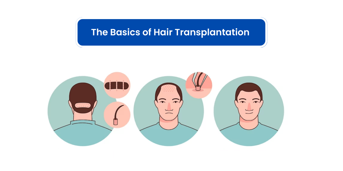 The Science Behind Hair Transplants: How It Works and Why It’s Effective ? - Best Hair Help